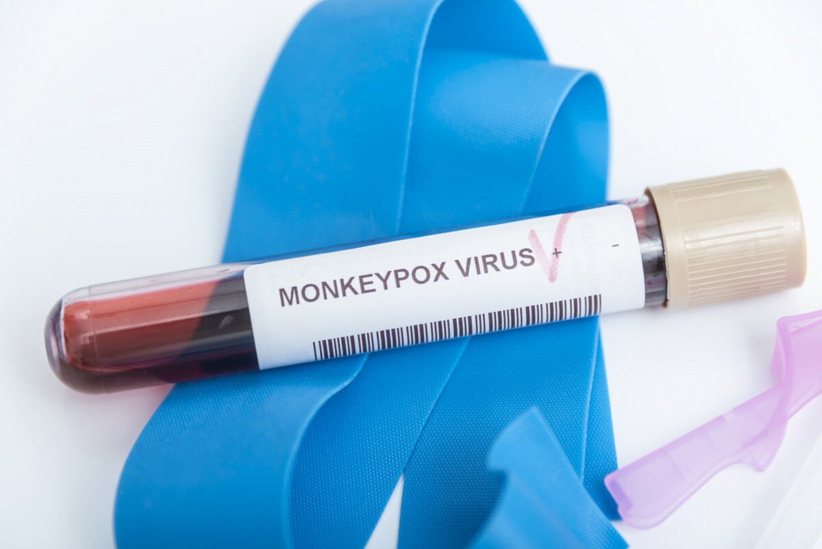 Antalet fall av apkoppor växer snabbt - VeterinärMagazinet